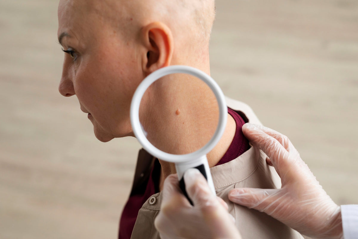 A Guide to Recognize Skin Cancer Signs | Dansons Medical